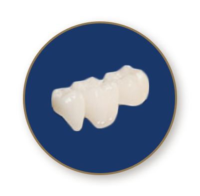 All-Ceramic – O-TEC Dental Laboratory